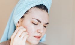 Skin Picking tips | Counseling | Therapy